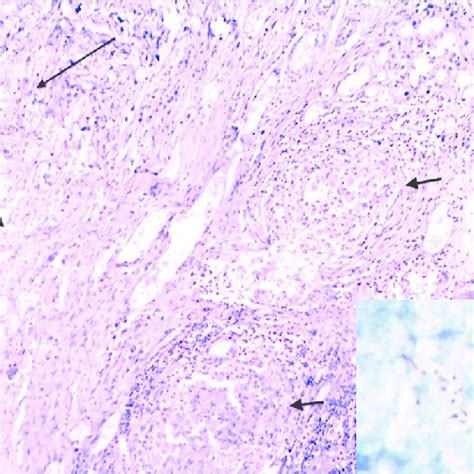 Gross Photograph Of Segment Of Rectosigmoid Region With Narrow Download Scientific Diagram