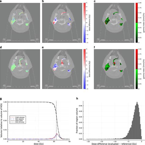 Visualizations Of Quality Assurance Qa Analysis For 63 Gy Planning Download Scientific