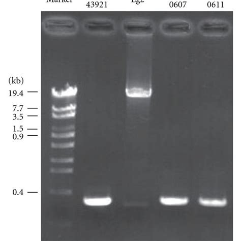 Expression Of The Capsule Gene Cluster In L Garvieae Strains Isolated