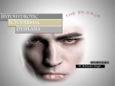 Pdf Ectodermal Dysplasia A Case Report And Overview Dokumen Tips