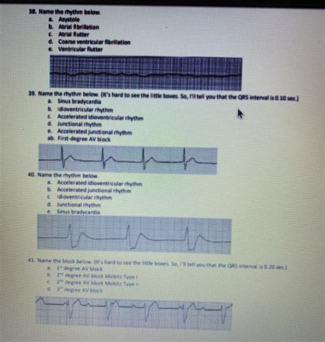 Idioventricular Rhythm Vs Junctional