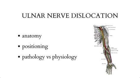 Ulnar Nerve Dislocation Musculoskeletal Ultrasound Examination Youtube