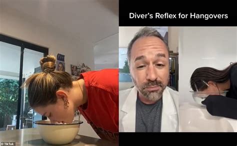 Doctor Goes Viral On Tiktok For Surprising Hangover Hack Daily Mail