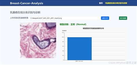 基于深度学习的乳腺癌分类识别与诊断系统基于深度学习的多癌种分类框架kumar Csdn博客