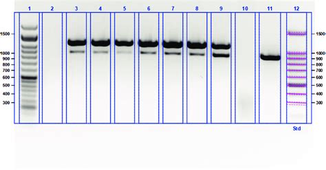 Gradient Pcr Amplification Of The 16s 18s Rrna Genes From Haematococcus Download Scientific