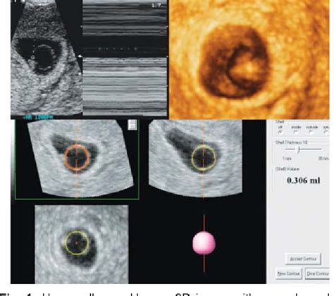 Figure 1 From Early Detection Of Fetal Abnormality Semantic Scholar