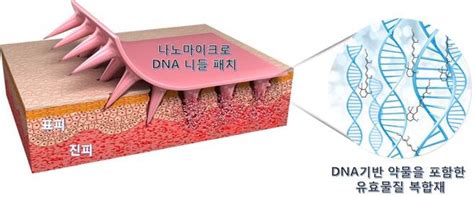 피부로 약물전달나노마이크로 Dna 니들패치 상용화 추진