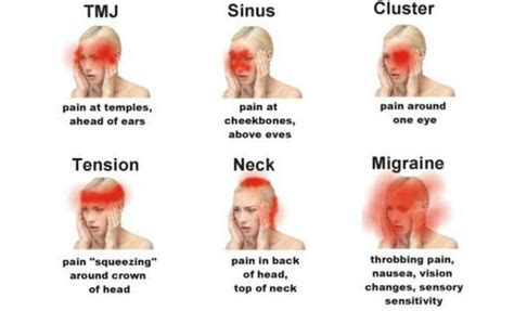 Understanding Headaches