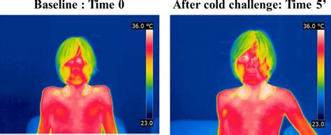 Representative Image Of Infrared Thermography Based Measurements Of The Download Scientific