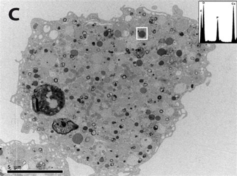 Electron Microscopy Demonstrating Scaffold Colonization Of Bdscs