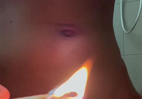 Belly Button Burning Part 3 Belly Button Burning Part 3