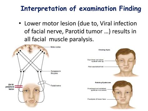 Cranial Nerve Examination Pptx