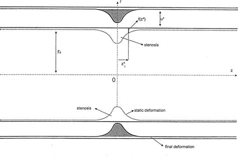 Figure 1 From The Effect Of A Bump In An Elastic Tube On Wave