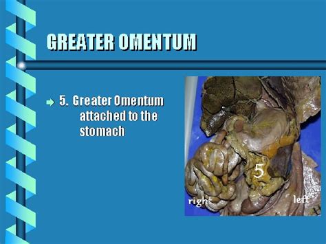 Greater Omentum