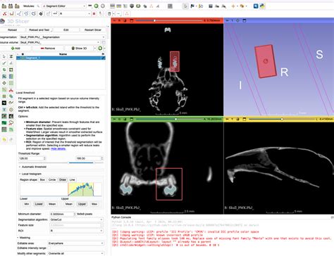 how to use local threshold feature requests 3d slicer community