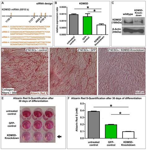 Human Sex Matters Y Linked Lysine Demethylase 5d Drives Accelerated