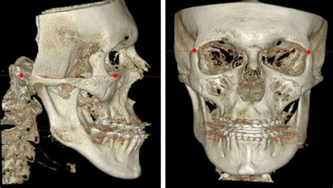Radiological Examination Of The Relationship Between The