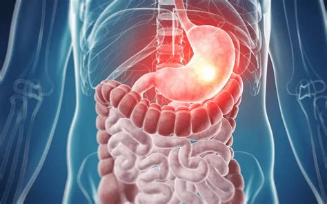 Gist Shedding Light On Its 10 Most Common Symptoms