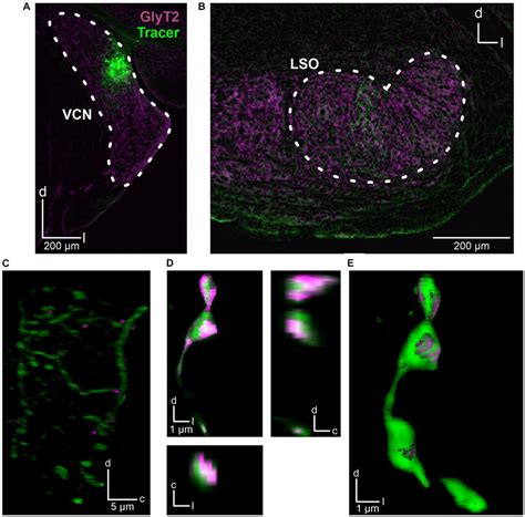 Anatomical Tracing Of Inhibitory Cn Lso Projections A Injection Site
