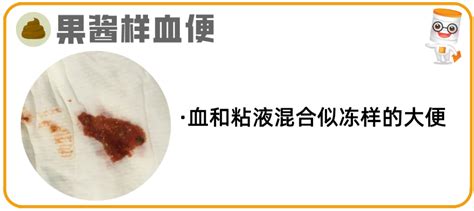 逾20种宝宝大便图片详解！最后10种必须警惕！ 知乎