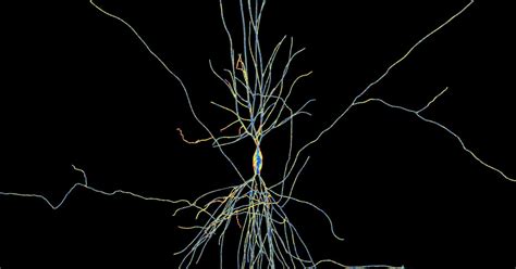 Is It A Quirky Behavior Or Alzheimers Psychology Today