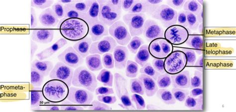 Biology Of Neoplastic Growth Flashcards Quizlet