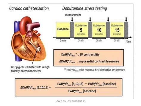 Low Flow Low Gradient Aortic Stenosis Pptx