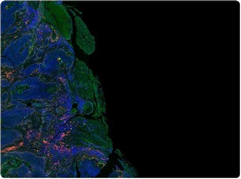 Bimolecular Fluorescence Complementation Bifc