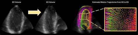 Continuous 3d Myocardial Motion Tracking Via Echocardiography Ai