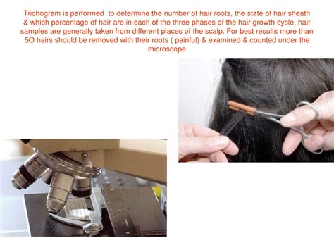 Ppt Trichoscopy Powerpoint Presentation Free Download Id9332303