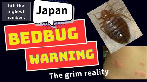 Bed Bug Warning In Japan The Silent Invaders From Rashes To