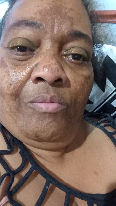 Pin By Beverly On Bev Face Big Lips Natural Big Lips Carnival Face