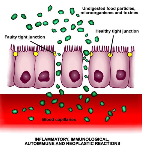 Exploring The Gut Microbiota Hypothesis Of Neurodegenerative Disease Pathogenesis ICJS