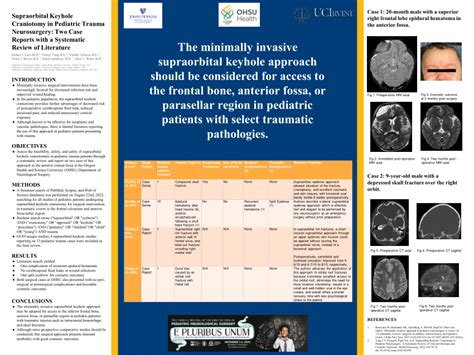 Pdf Supraorbital Keyhole Craniotomy In Pediatric Neurosurgery A Systematic Review Of Clinical