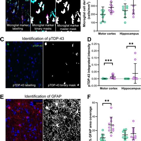Microglial Cell Density Ptdp 43 And Gfap Load Are Increased In Als