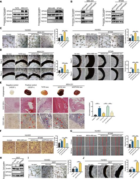 Exosomal Epha2 Derived From Highly Metastatic Breast Cancer Cells