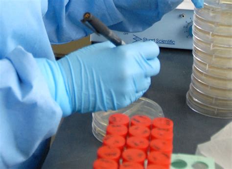 DNA Sequencing Used To Track Transmission Of Incurable TB In South Africa UCT Lung Institute