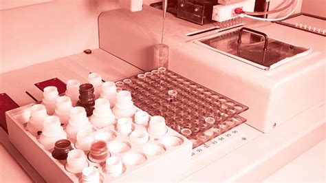 Automating Sample Preparation Lab Manager