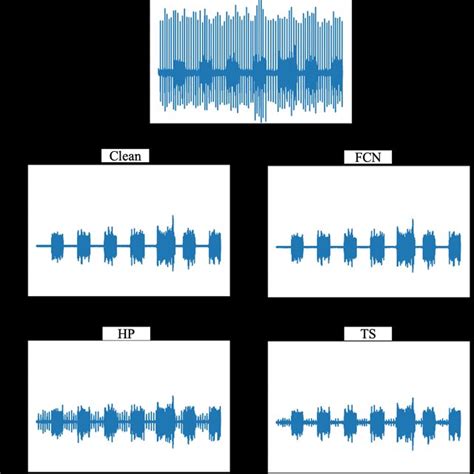 Waveform Of The Reconstructed Semg Signals By Different Ecg Artifact Download Scientific