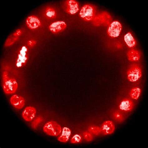 Phenovue Draq5 Total Cell Nuclear Stain 50 µl Revvity
