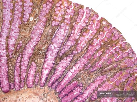 Light Micrograph Of Goblet Cells In Colon — Epithelium Cytology