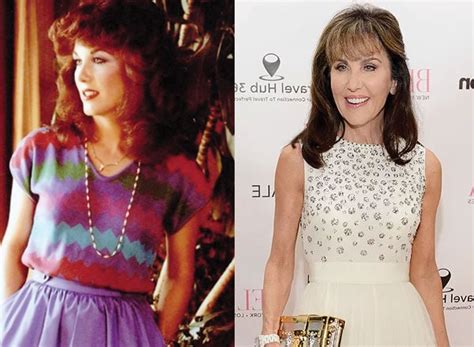 Robin Mcgraw Plastic Surgery Before And After Pictures 2025