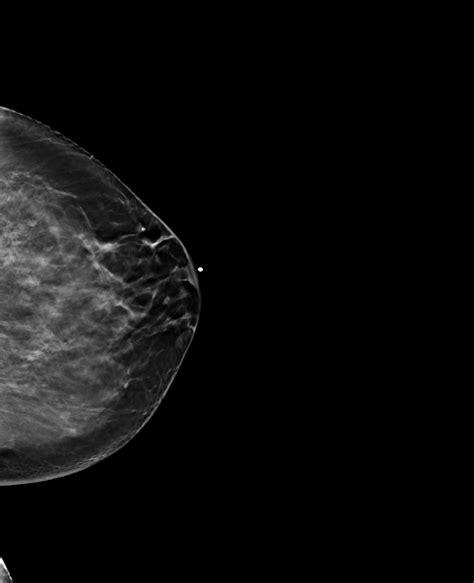 Dbt Train Object Detection Dataset By Teknofest