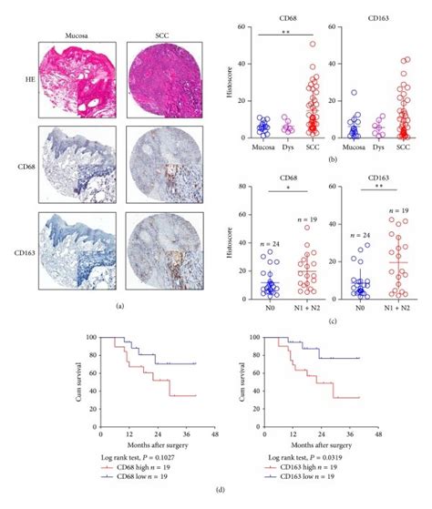 Human Oscc Tissue Array Analysis Revealed That Cd68 And Cd163 Were