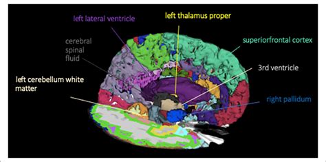 subcortical surface segmentation showing all brain structures with
