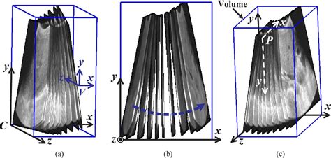 Figure 5 From Real Time Visualized Freehand 3d Ultrasound Reconstruction Based On Gpu Semantic