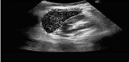 Filtered Image Using Sobel Filter Download Scientific Diagram