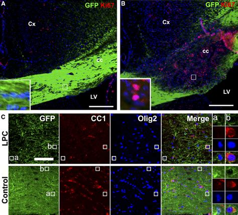 Lpc Induced Demyelination In The Plp Gfp Transgenic Line A B Download Scientific Diagram