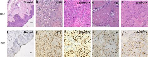 Histological And Molecular Characterization Of The Oral Cancer Pdtx