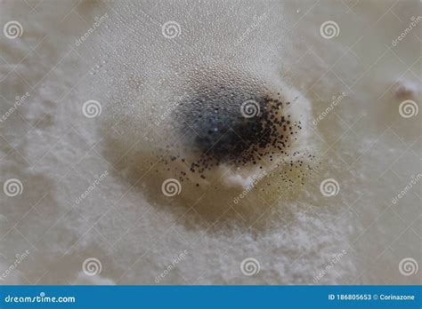 Aspergillus Niger And Aspergillus Oryzae Mold Under Microscope Royalty